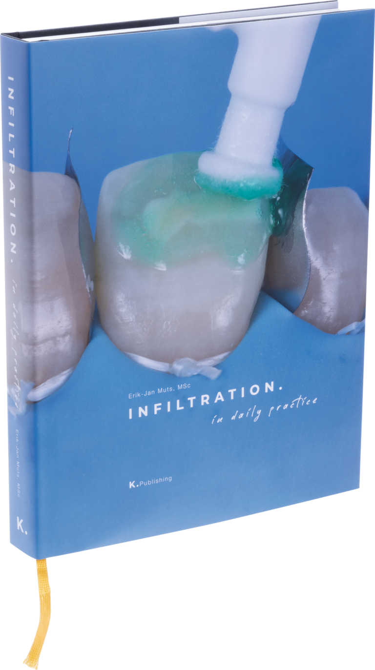 The Infiltration book - Karma Dentistry