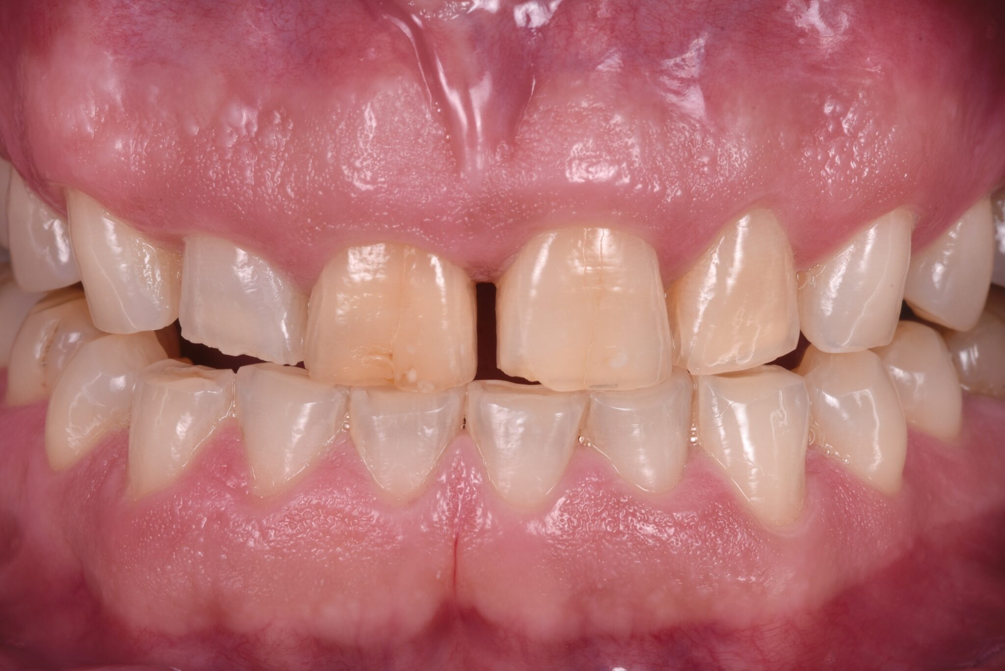 Karma. Wear live course - Karma Dentistry
