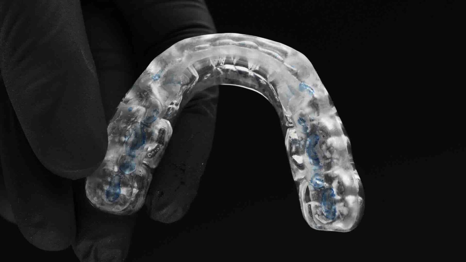 Splint Therapy by Karma. Dentistry