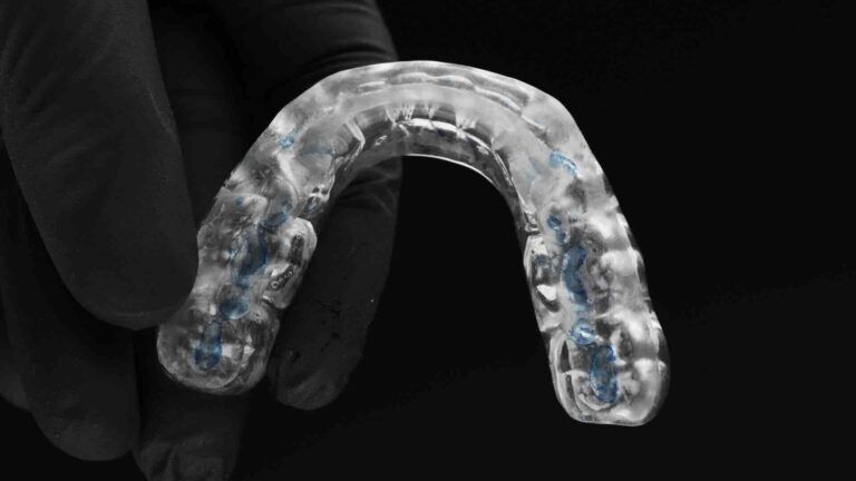 Splint Therapy (complete online course) - Karma Dentistry